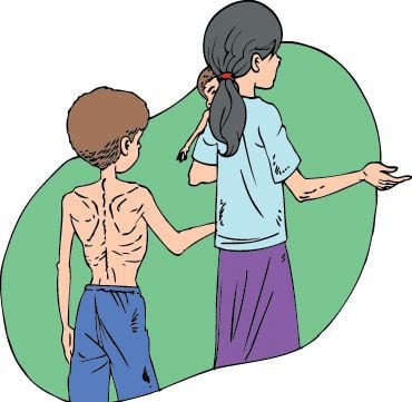 El hambre y la desnutrición en el siglo XXI - Escolar - ABC Color