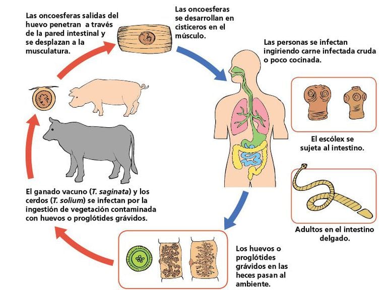 Teniasis - Escolar - ABC Color