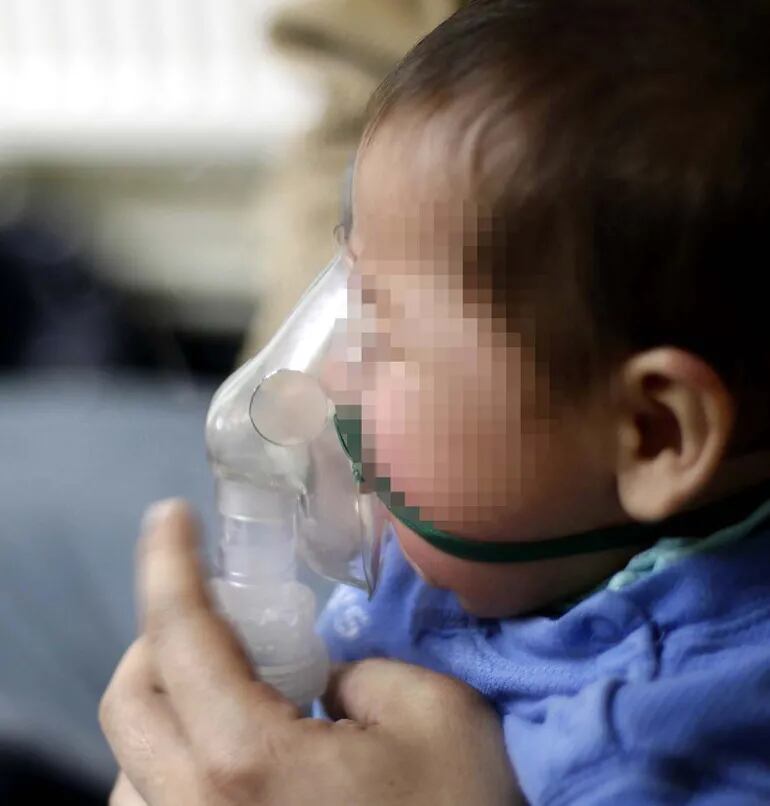 La tos convulsa - Salud - ABC Color