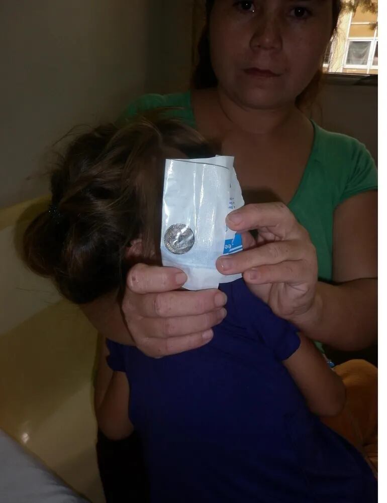 Extraen moneda del esófago a una niña de cinco años - Nacionales - ABC ...
