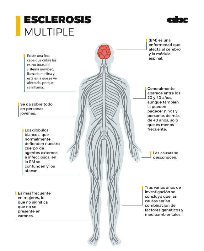 Esclerosis múltiple: vivir con mil rostros - Notas - ABC Color